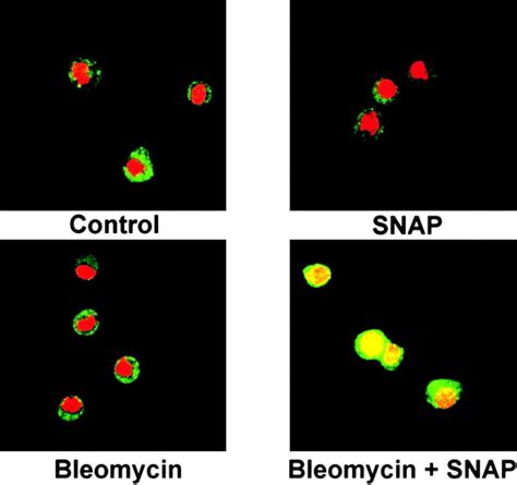 An No Donor Promotes Bleomycin Induced P53 Activation In Vitro