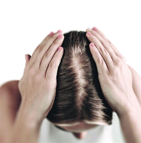Alopecia sau căderea părului cauze tratamente Jurnalul de Estetica