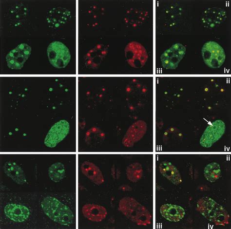 The Sp100 Variants Display Distinct Subnuclear Localization Behavior