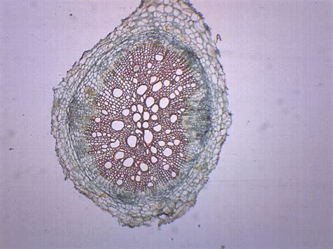 Monocot Root Under Microscope