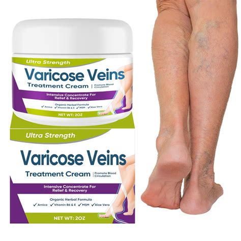Buy Varicose Veins Cream Natural Varicose Veins For Legs Relieve Spider Veins Phlebitis And