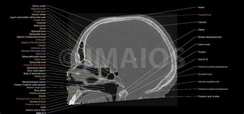 Bones Of Cranium Anatomy Ct Sphenoid Bone Occipital Bone Clivus