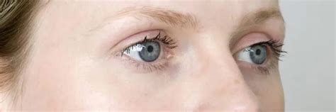 Sparse Eyebrows How To Fix Them Global Medical Care