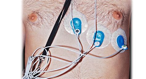 Holter Elektrokardiogram Holter Ekg Poliklinika Kardioton