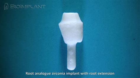 Bioimplant On Tumblr