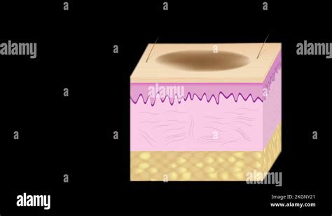 Skin Pigmentation Illustration Stock Videos And Footage Hd And 4k Video