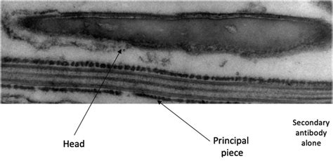 Electron Microscopy Of The Head And Principal Piece Of The Flagellum