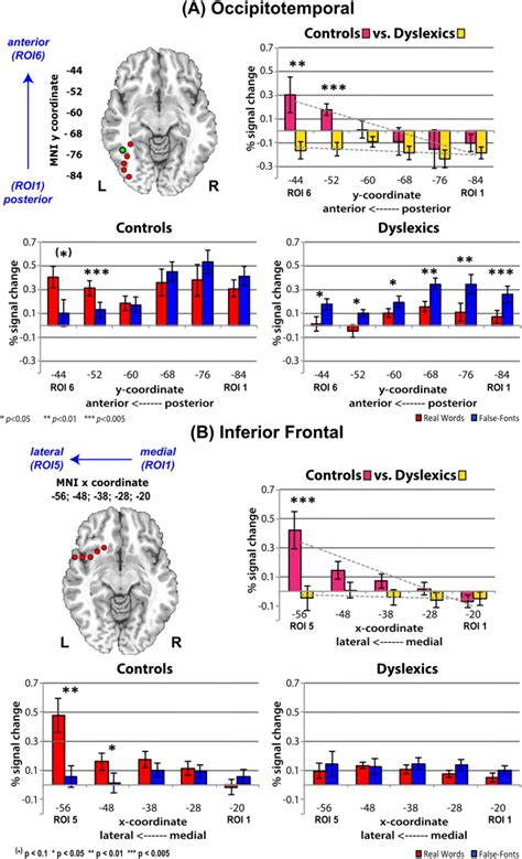 Region Of Interest Analysis In Left Hemisphere Occipito Temporal And Download Scientific