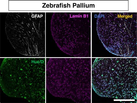 Dynamic Expression Of Lamin B1 During Adult Neurogenesis In The