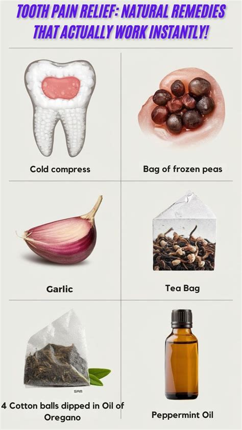 Wisdom Tooth Ache Artofit