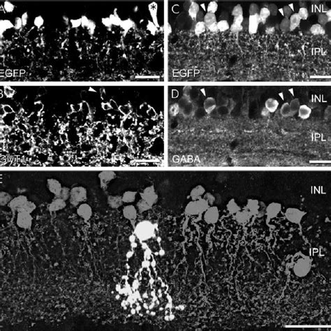 Morphological Identification Of The Recorded Amacrine Cells A Typical