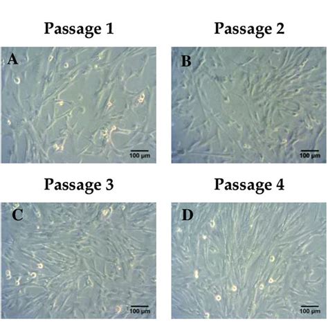 Morphological Characteristics Of Adipose Derived Mesenchymal Stem Cells