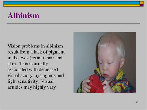 Ppt Infant Vision Development And Eye Diseases Powerpoint