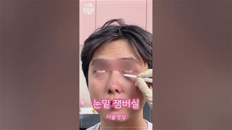 잼버실 실제 시술영상 Shorts Youtube