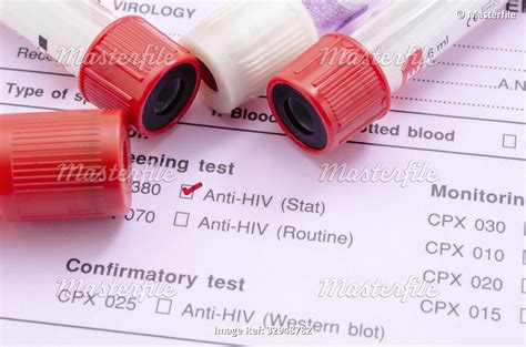 32948782 Sample Blood Collection Tube With Hiv Test Lab