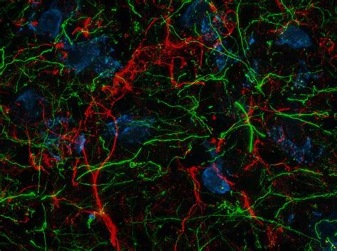 Media Cybernetics Introduces Gpu Deconvolution Media Cybernetics