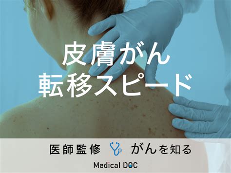 「皮膚がんの転移スピード」はご存知ですか？治療法や予防法も解説！【医師監修】 メディカルドック