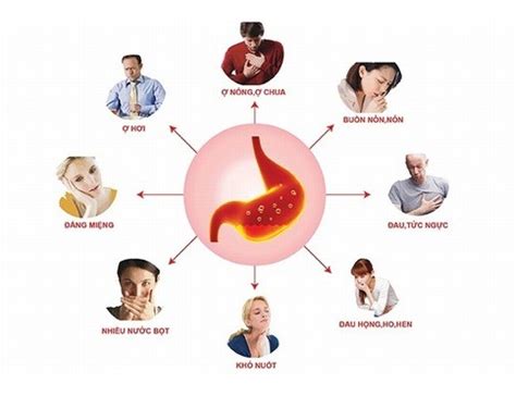 nguyên nhân gây trào ngược dạ dày thực quản BvNTP