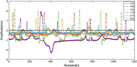 ecg signals from the mit bih database download scientific diagram