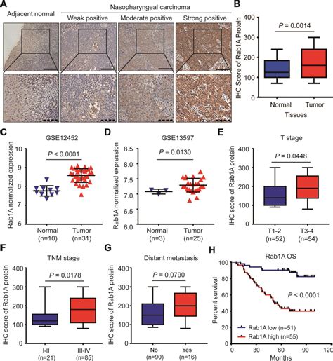 Figure 1 From Rab1a Promotes Cancer Metastasis And Radioresistance