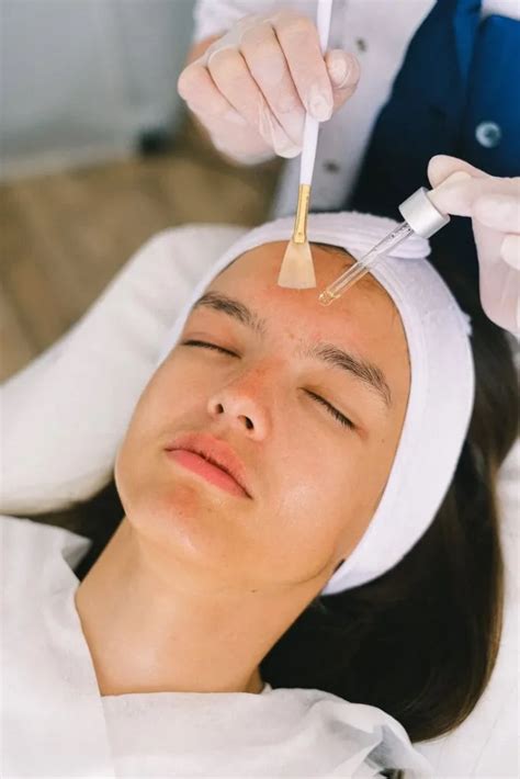 Acne Scar Treatment Luxskin