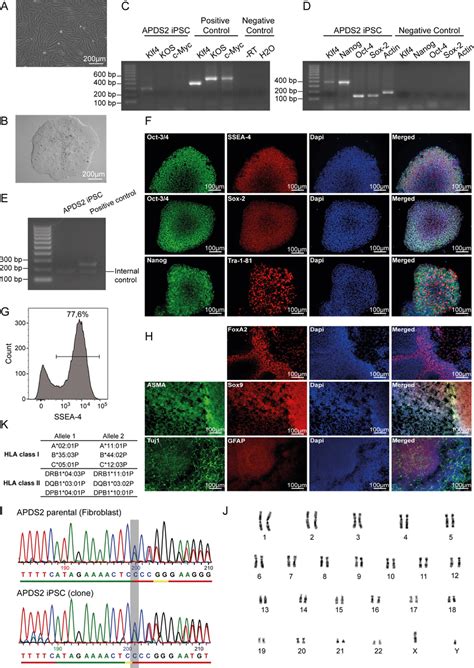 Characterization Of Apds2 Fibroblast Derived Hips Cell Line Download