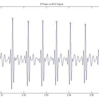 Detected R Peaks In ECG Signal Download Scientific Diagram