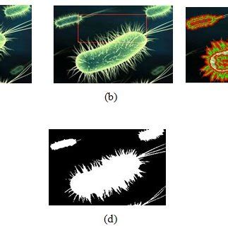 Segmentation Of Bacterial Image By The Proposed Method A Original Download Scientific