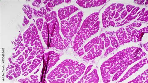 Large Vein Pattern In Section Filmed Under Microscope 100x On White