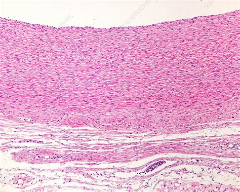 Wall Of An Elastic Artery Light Micrograph Stock Image C0361233