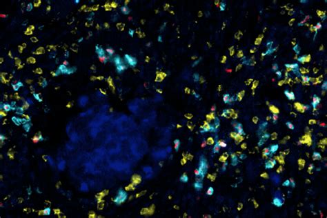 Checkpoint Therapy Could Be Enhanced By Cutting Cd8 T Celltreg Crosstalk