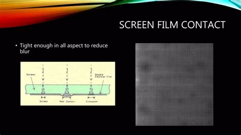 Radiographic Intensifying Screen Pptx