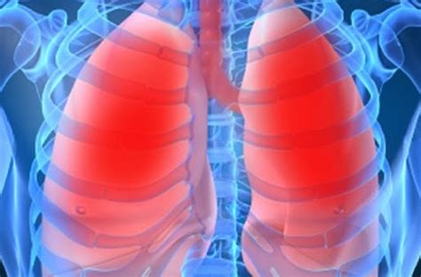 Fda Approves Treatment For Rare Lung Disease Scleroderma Fda Health News