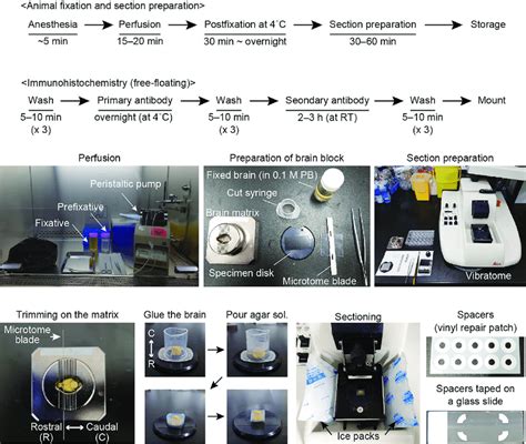 The Timing And Workflow Of Immunohistochemistry Using Fixed Brain