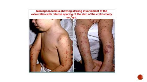 Approach To Skin Rash Pptx
