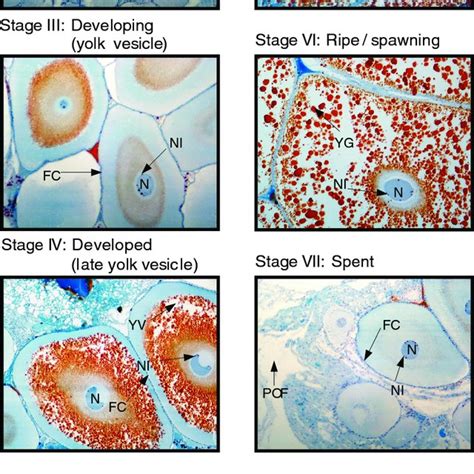 Microscopic Appearance Of The Different Gonadal Developmental Stages Of