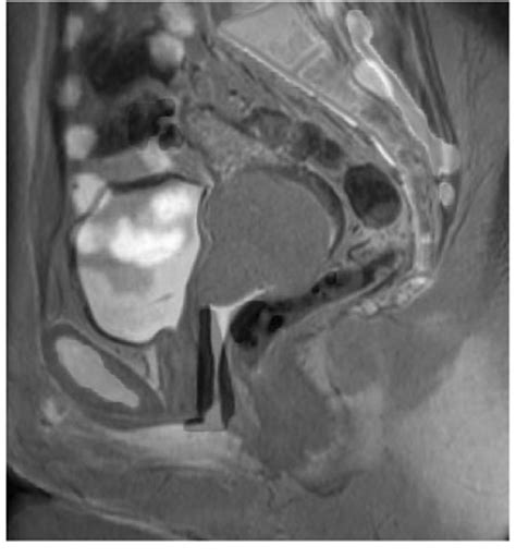 Blended Sagittal CT MR From Figure Highlighting The Differences Download Scientific Diagram