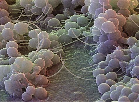 Staphylococcus Epidermidis Bacteria SEM Stock Image B234 0111
