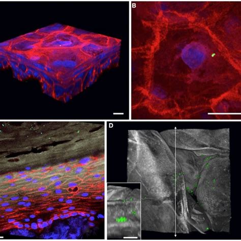 Staphylococcus Aureus Adherence Growth And Localization Can Be Download Scientific Diagram