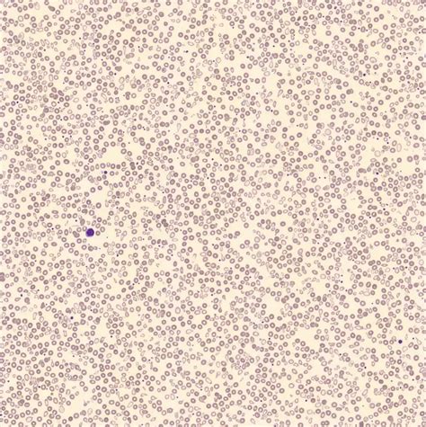 Teardrop Cells Cellwiki