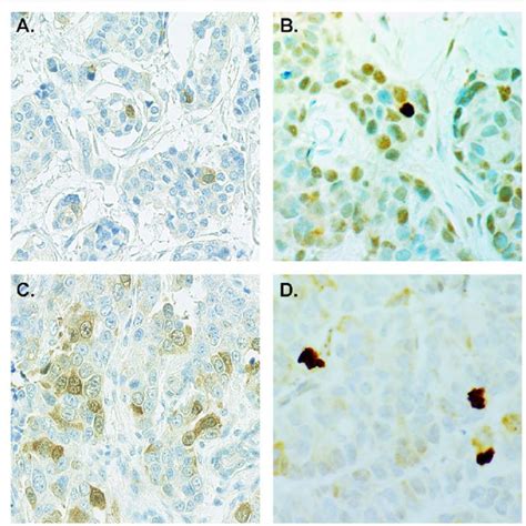 Abbreviations APC C Anaphase Promoting Complex Cyclosome Cdc20
