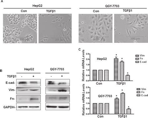 Tgf β1 Induced Emt In Hepatoma Cells A Cells Were Treated With Or
