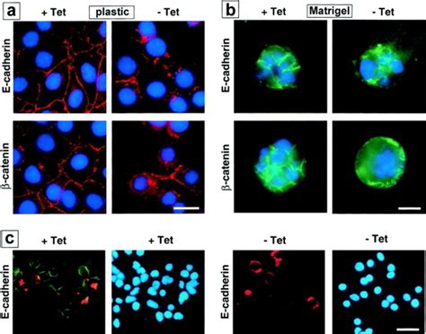 Subcellular Localization Of E Cadherin And β Catenin After Sl 1