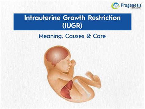 Iugr In Pregnancy Meaning Causes And Management Tips