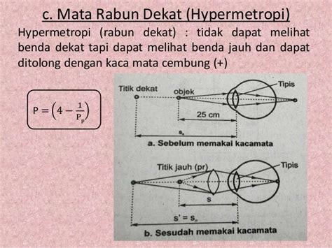 Fisika Mata Lup Ohp Mikroskop Lensa Optik