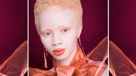 Thando Hopa Im A Black Woman Who Refuses To See My Albinism As A