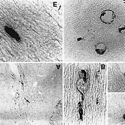 Representative Photomicrographs Revealing Axonal And Neuronal