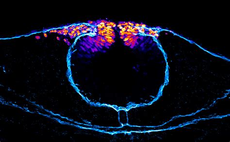 Building The Neural Crest Elife Science Digests Elife