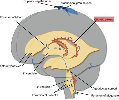 知识笔记丨典型的脉络膜前动脉梗死 动脉综合征 脉络 动脉 梗死 健康界 医学