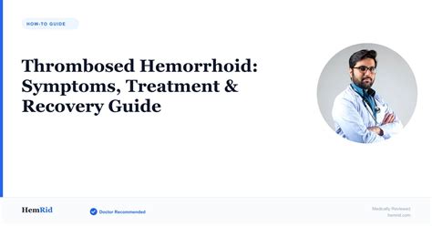 Thrombosed Hemorrhoid Symptoms Treatment And Recovery Guide 2026